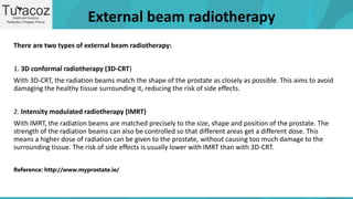 Prostate Cancer by Dr Ankita Purkite | PPTX