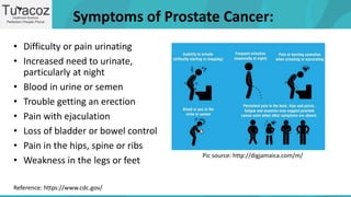 Prostate Cancer by Dr Ankita Purkite | PPTX