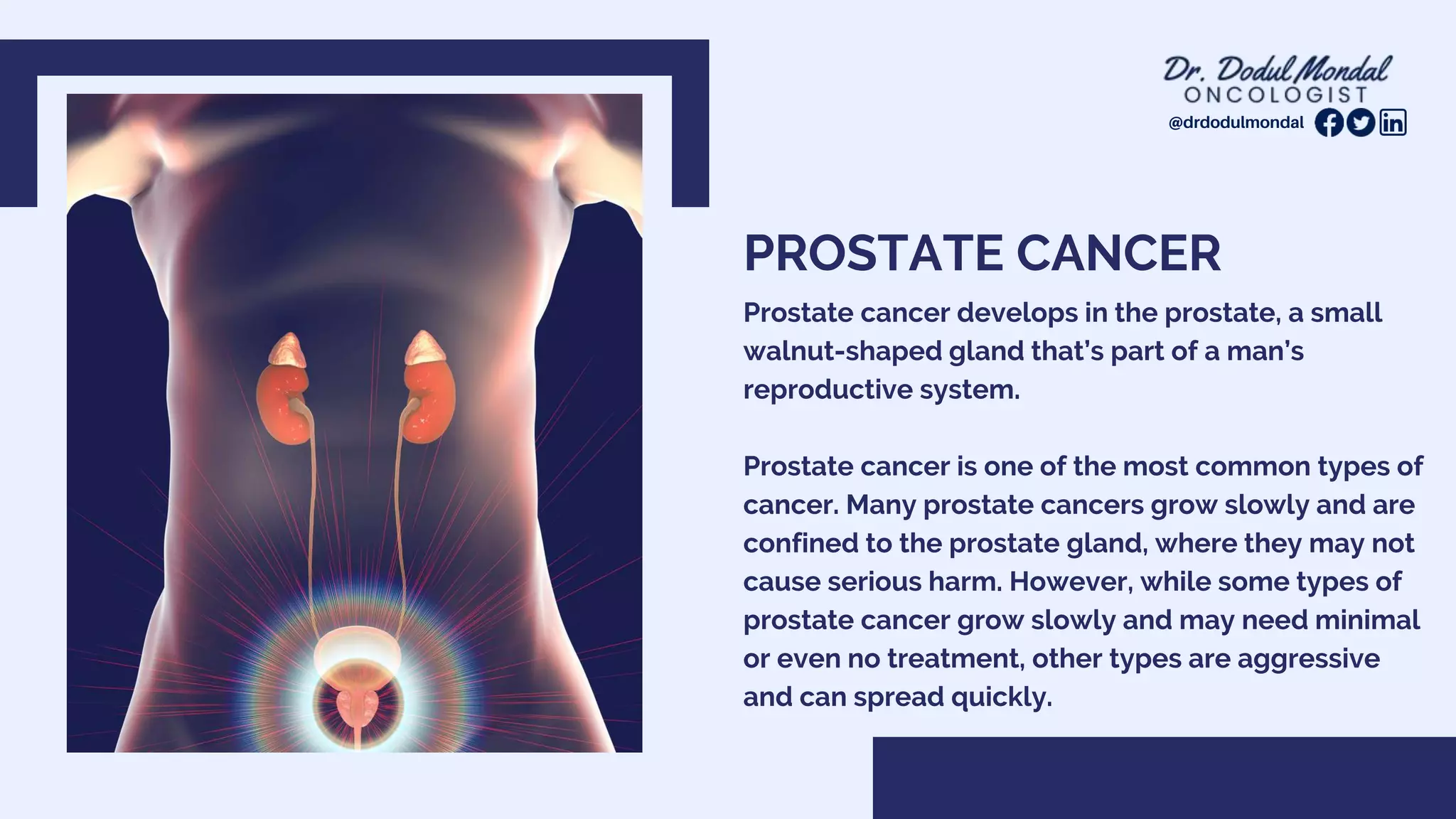 Prostate Cancer .pptx