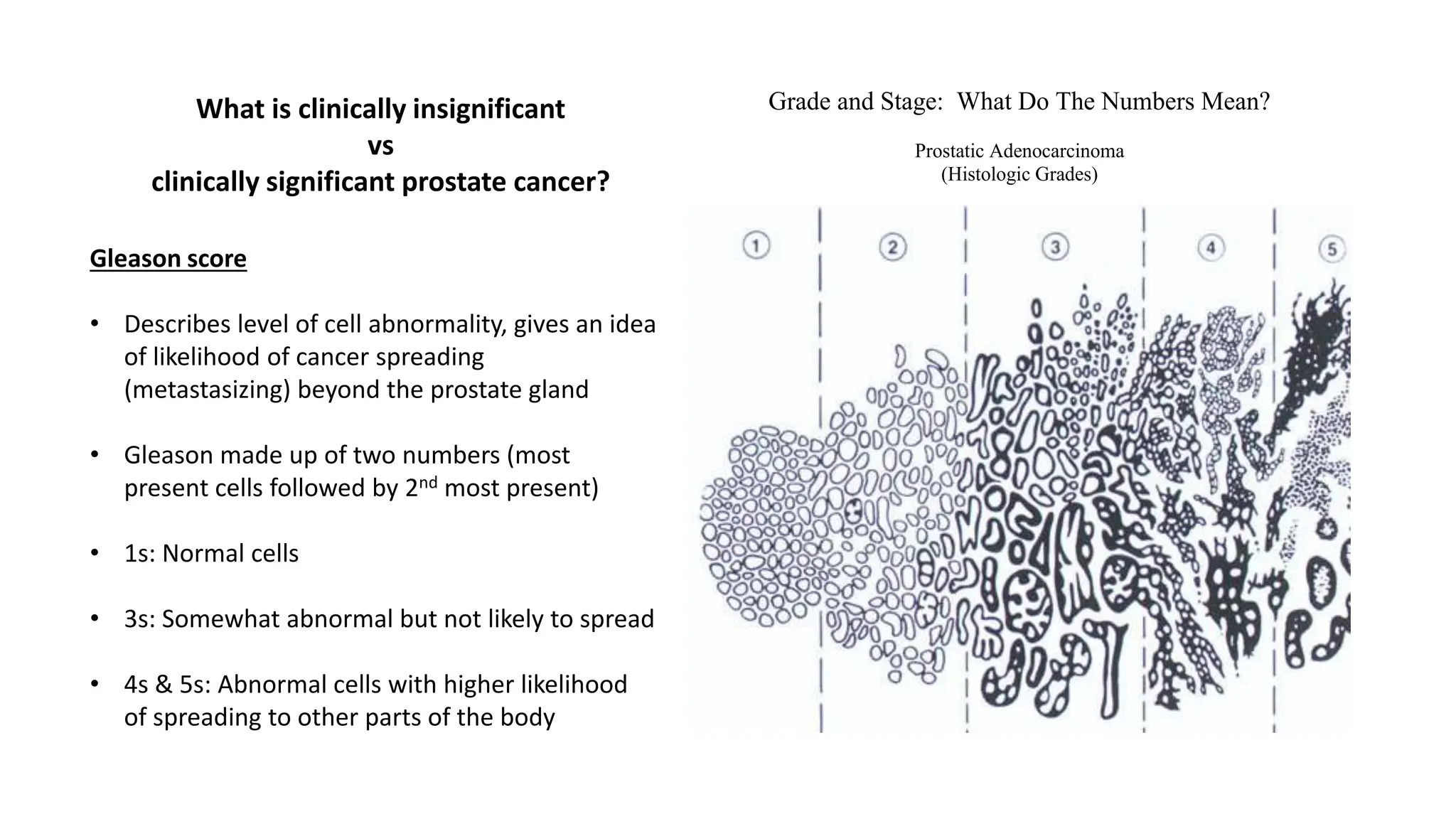 Prostate cancer presentation 2024 Cancer Support Now.pptx