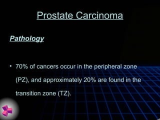 Prostate carcinoma | PPT