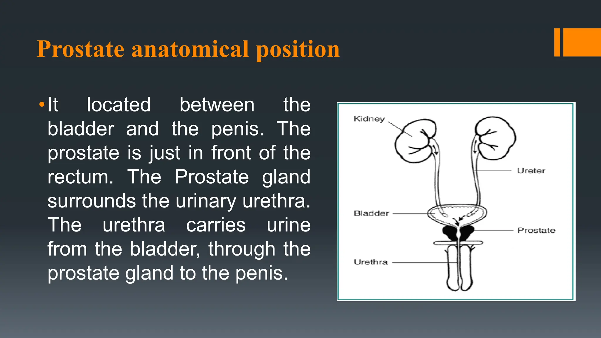 prostatectomy with urinary incontinence-1 (1).pdf