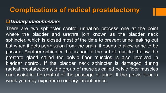 prostatectomy with urinary incontinence-1 (1).pdf
