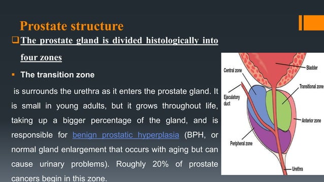 prostatectomy with urinary incontinence-1 (1).pdf