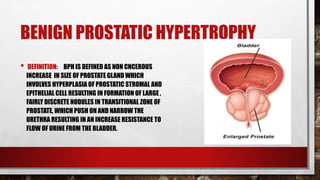prostate disorders 2.pptxjdhdhsuridjhrgrbrnf | PPTX