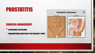prostate disorders 2.pptxjdhdhsuridjhrgrbrnf | PPT