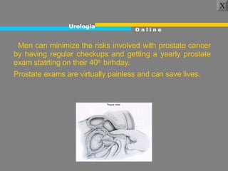 Prostate Exam | PPS
