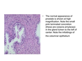 PROSTATE GLAND-1.ppt777777777777777777777777777777 | PPT