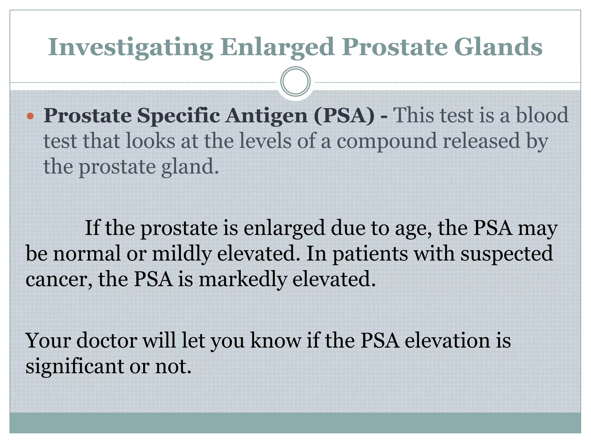 Understanding Enlarged Prostate Glands - Dr Vivek Baliga Patient ...