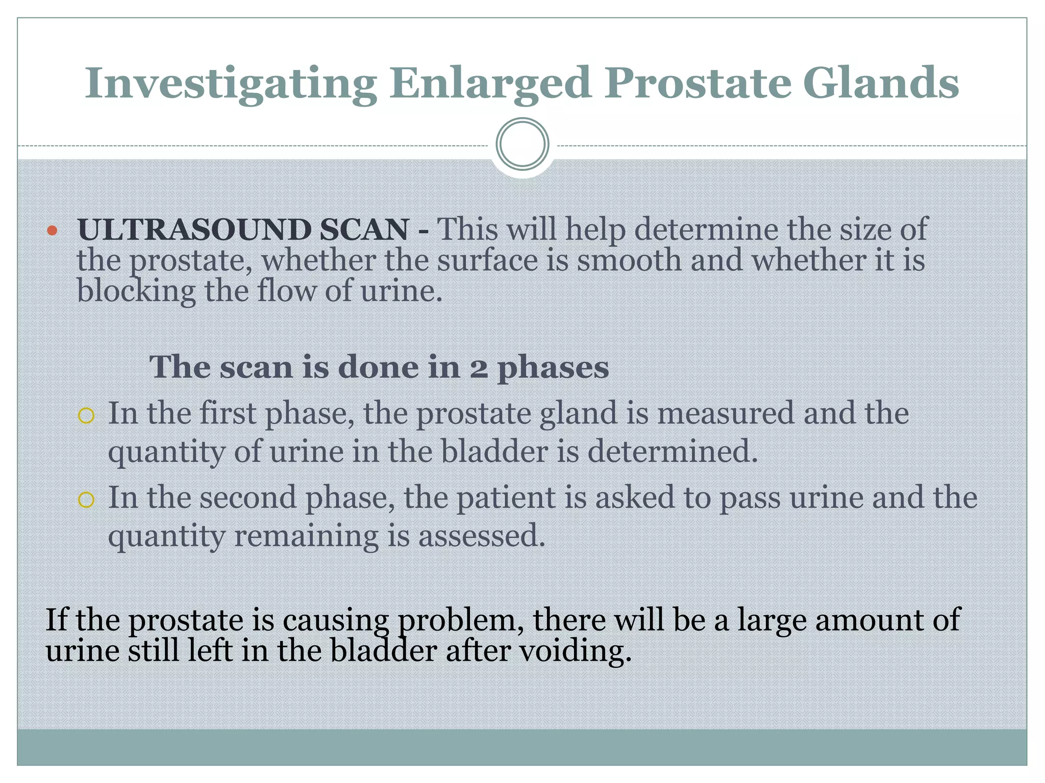 Understanding Enlarged Prostate Glands - Dr Vivek Baliga Patient ...