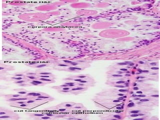 Prostate gland.pptx human anatomy human anatomy | PPTX