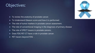 Prostate imaging | PPTX