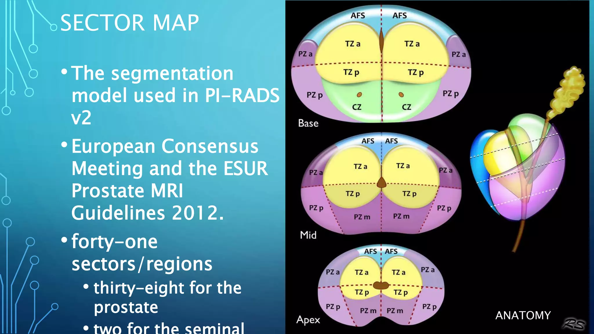 Prostate Imaging - PI-RADS v2.1 | PPTX