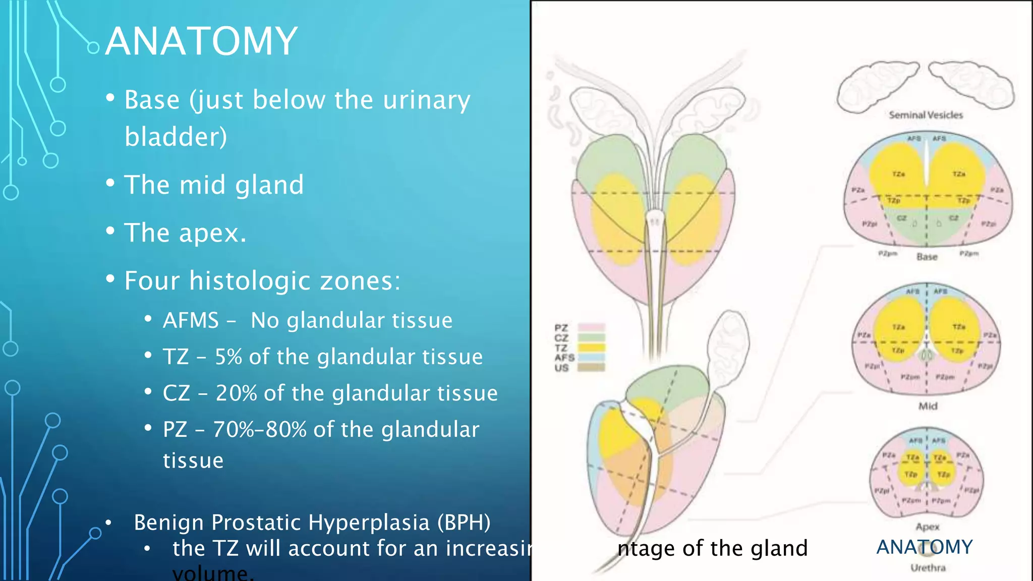 Prostate Imaging - PI-RADS v2.1 | PPTX