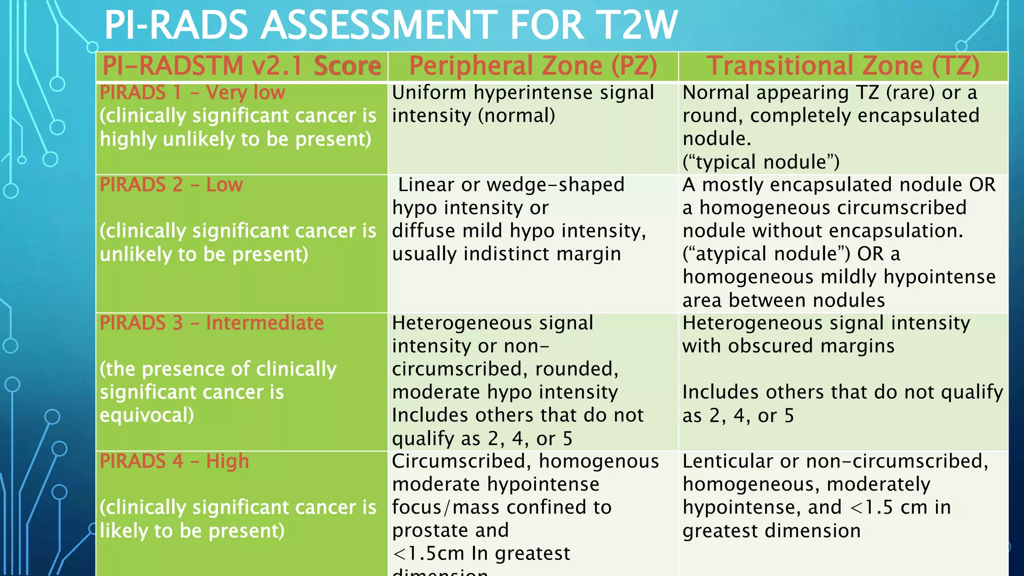 Prostate Imaging - PI-RADS v2.1 | PPTX