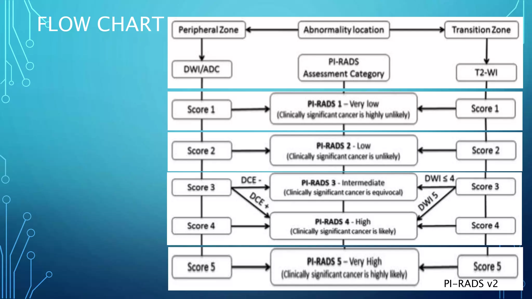 Prostate Imaging - PI-RADS v2.1 | PPTX
