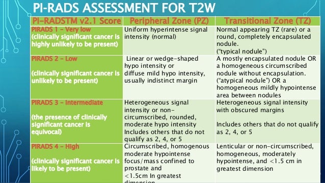 Prostate Imaging - PI-RADS v2.1