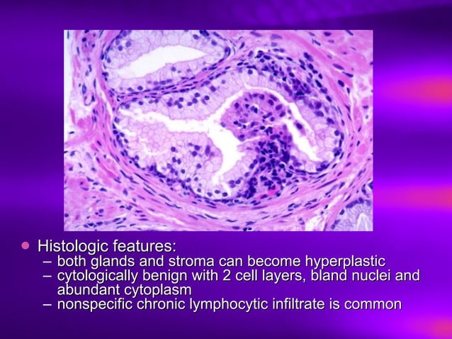 Prostate Pathology | PPT | Endocrine and Metabolic Diseases | Diseases ...
