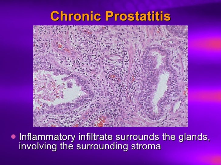 Prostate Pathology