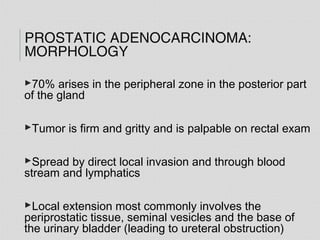 Prostate pathology, Dr. Sufia Husain, March 2018 | PPT