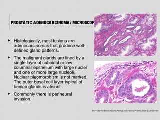 Prostate pathology, Dr. Sufia Husain, March 2018 | PPT