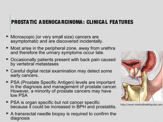 Prostate pathology, Dr. Sufia Husain, March 2018 | PPT
