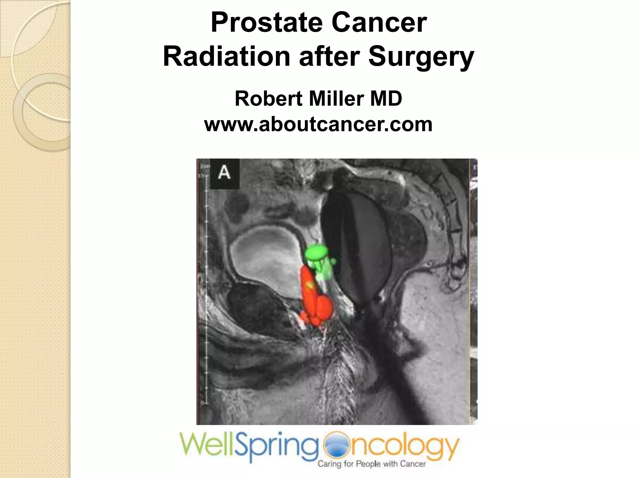 Prostate Cancer and the Role of PostOp Radiation | PPTX | Cancer ...