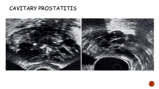 PROSTATE PRIYANKA prostate anatomy and physiology | PPTX