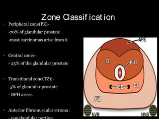 Anatomy, pathology an staging work up of prostate cancer | ODP