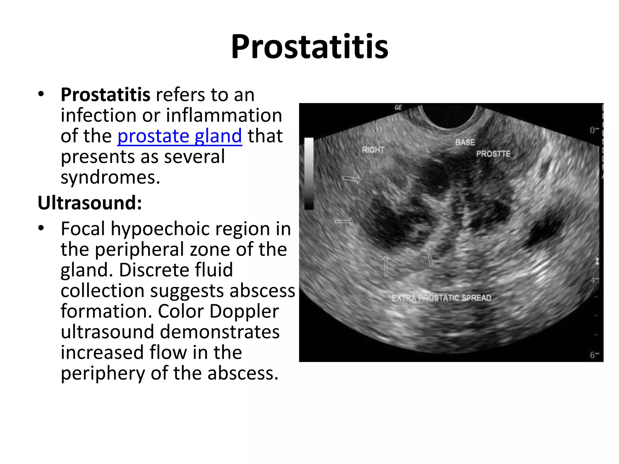 Prostate ultrasound (basic) | PPTX