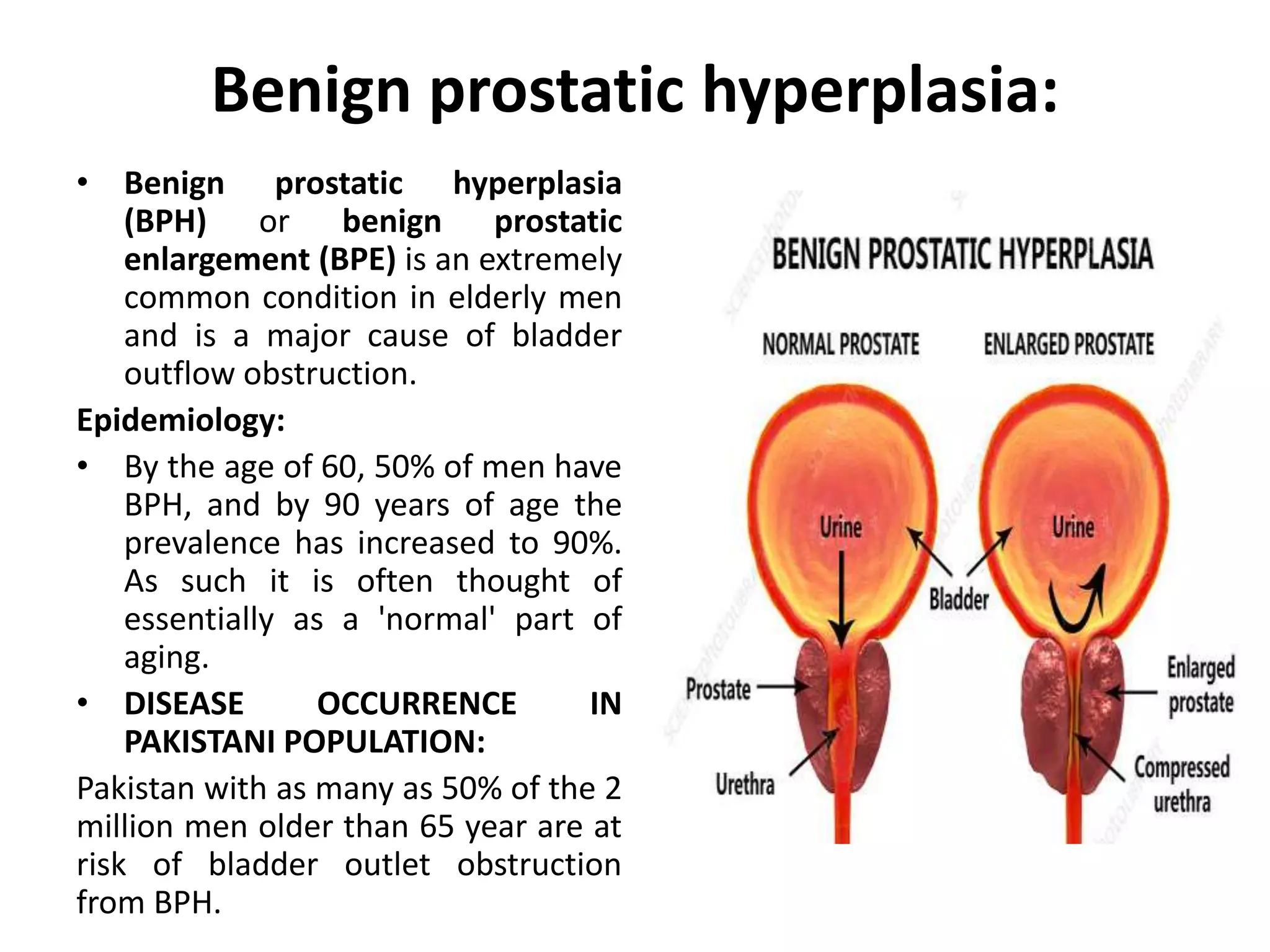 Prostate ultrasound (basic) | PPTX