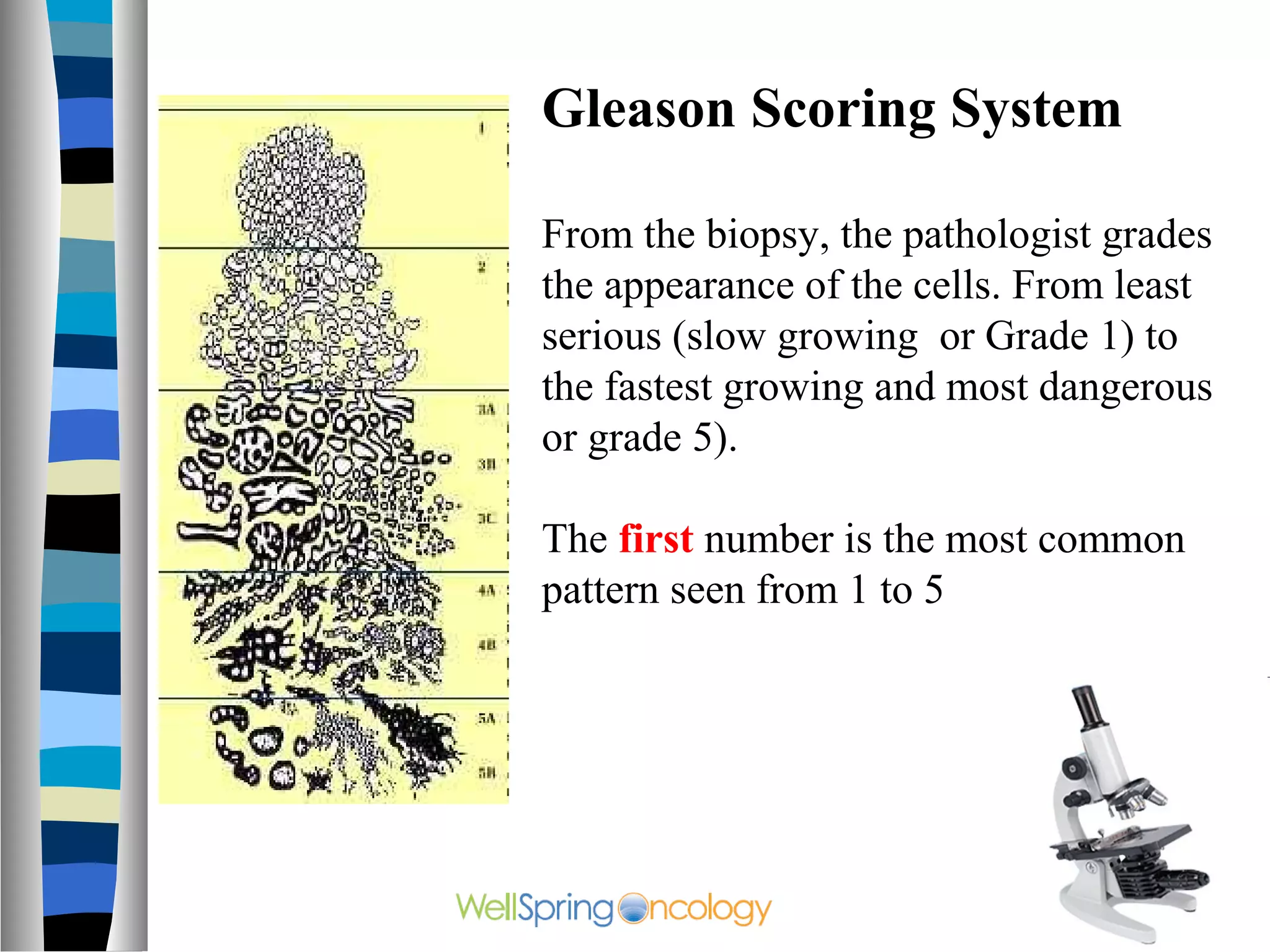Prostate video 1 | PPT
