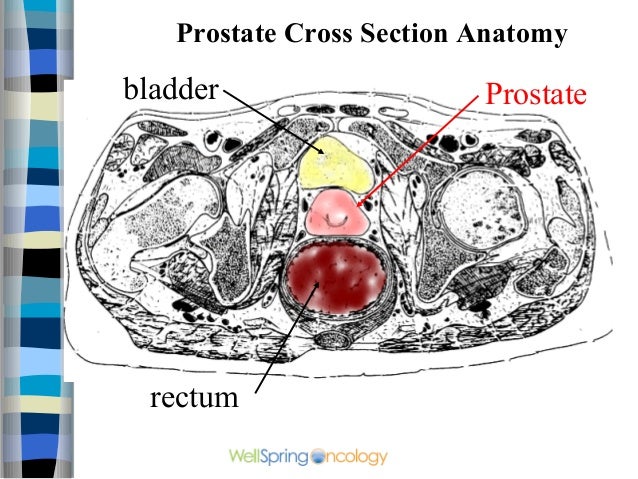 Prostate video 1