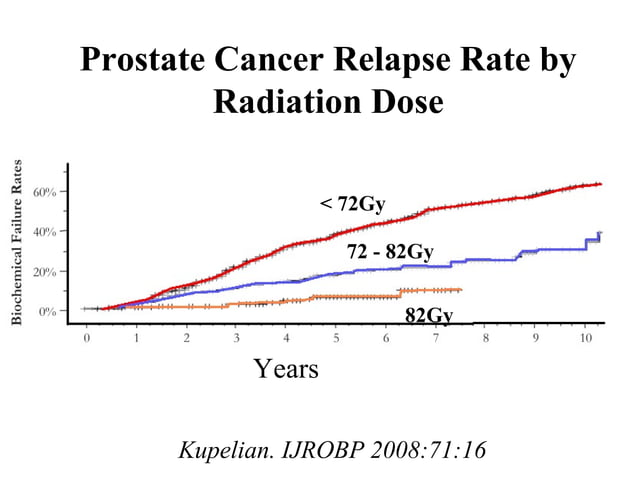 Radiotherapy for Prostate Cancer | PPT | Physical Therapy | Wellness