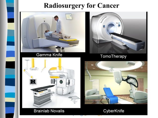 Radiotherapy for Prostate Cancer | PPT | Physical Therapy | Wellness
