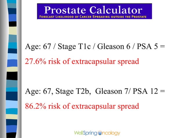 Radiotherapy for Prostate Cancer | PPT | Physical Therapy | Wellness