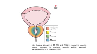 Prostate volume.pptx