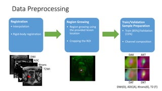 Prostate Cancer Diagnosis using Deep Learning with 3D Multiparametric ...