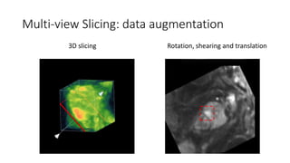 Prostate Cancer Diagnosis using Deep Learning with 3D Multiparametric ...