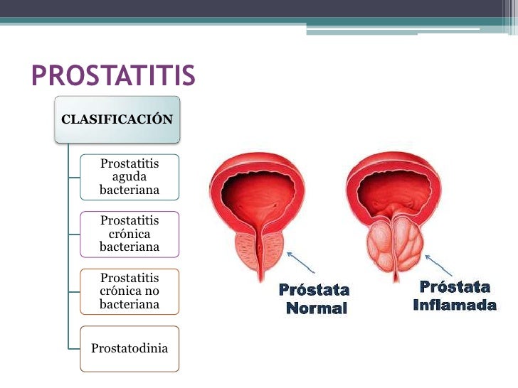 Prostatitis