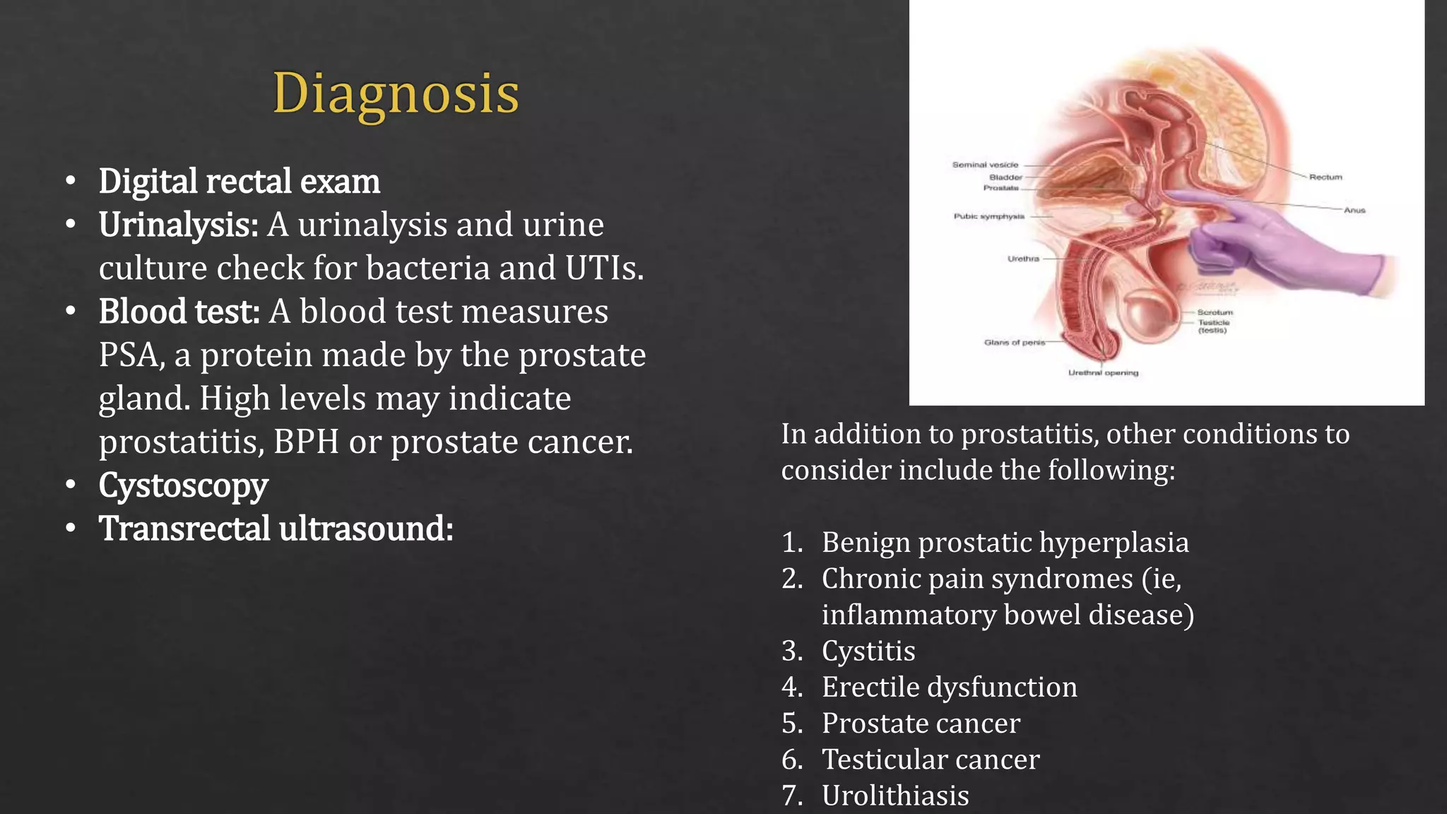 prostatitis.pptx
