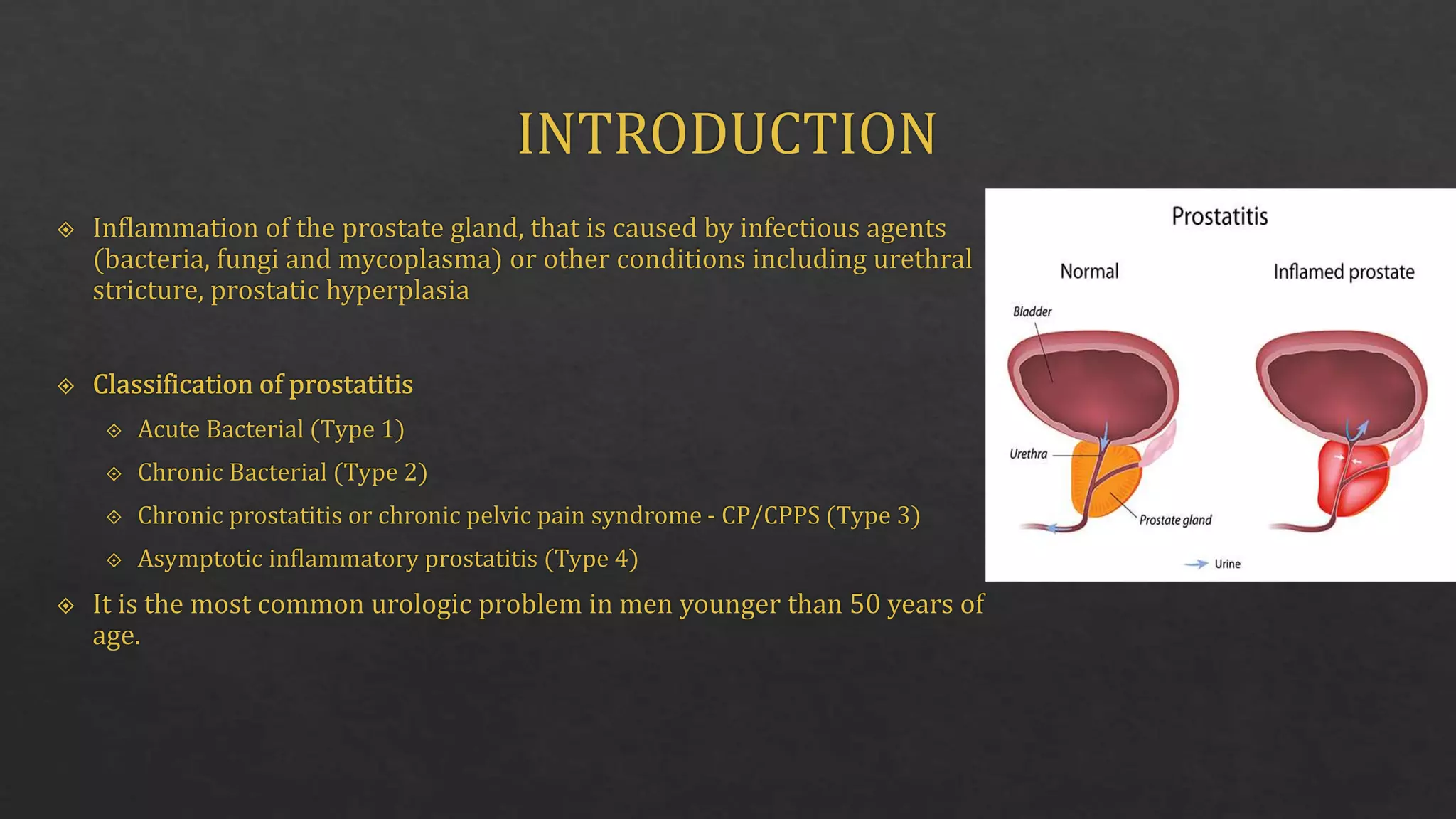 prostatitis.pptx