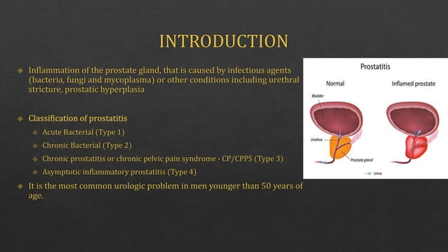 prostatitis.pptx