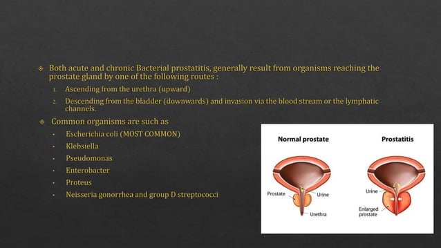 prostatitis.pptx