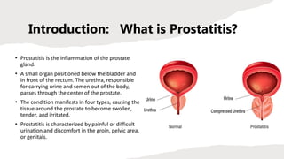 Prostatitis both Acute and Chronic .pptx