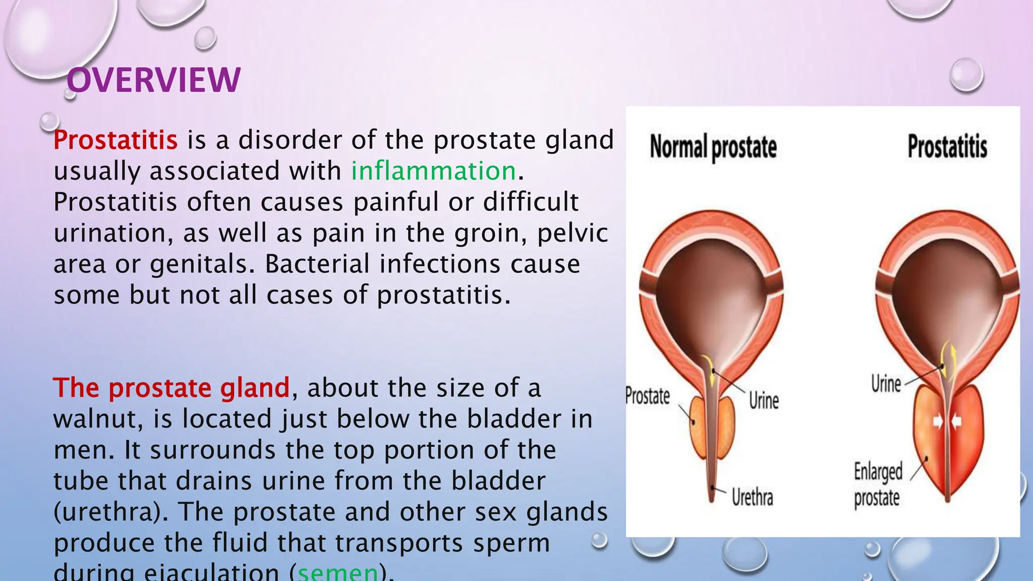 Prostatitis-ppt (1).pptx