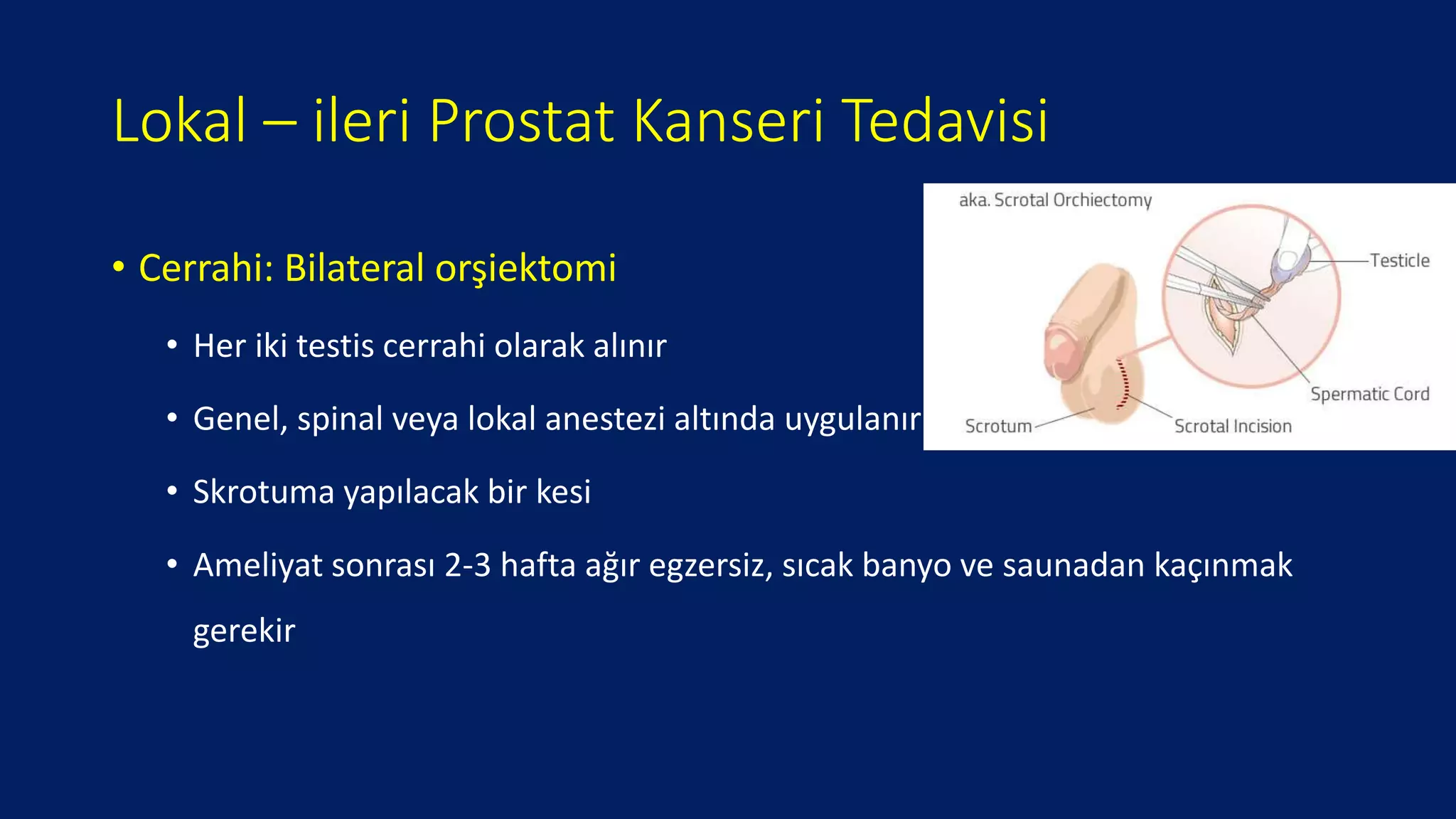 Prostat kanseri | PPTX