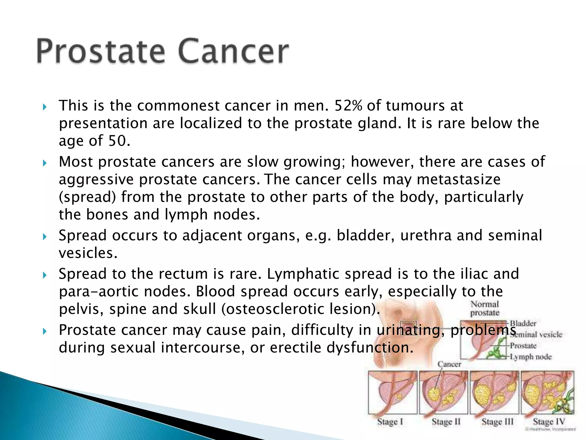 Prostatomegaly | PPTX
