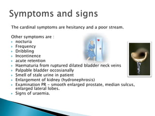Prostatomegaly | PPTX