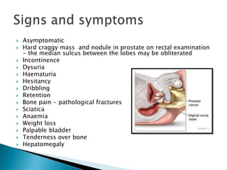 Prostatomegaly | PPTX